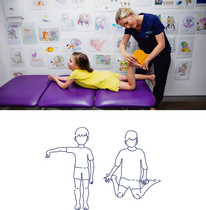 Hypermobility / Connective Tissue Disorder | LBF Podiatry – Little Big ...